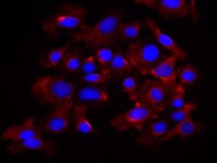 MOC1 Mouse Oral Squamous Cell Carcinoma (OSCC) Cell Line | SCC469